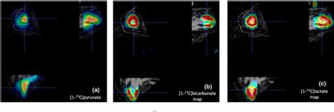 Figure 6 From Mri Application And Challenges Of Hyperpolarized Carbon 13 Pyruvate In