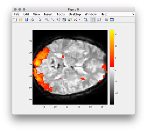 Brain Images In Matlab Ds Dafni