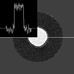 Conventional Magnitude MR Image Left And Calculated Electric Currentdensity Image Of The Same