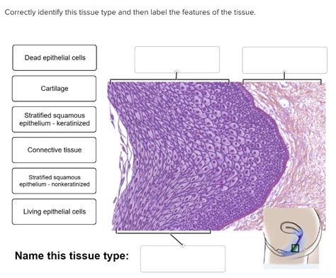 Solved Correctly Identify This Tissue Type And Then Label The Features Of The Tissue Dead