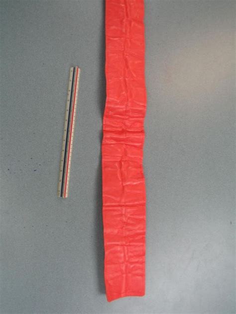 How To Make A Splint For The Hand Lifeguard First Aid