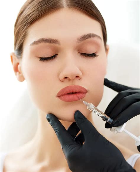 Best Lip Fillers In Tampa Fl Ravive Plastic Surgery