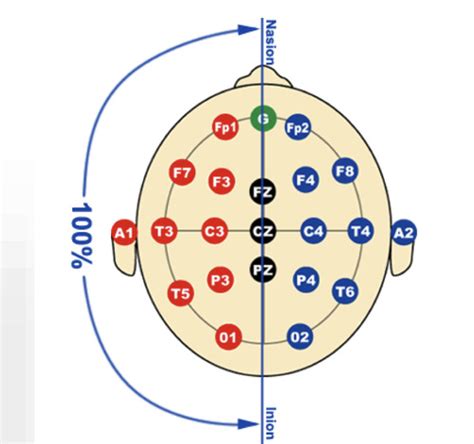 Eeg Flashcards Quizlet
