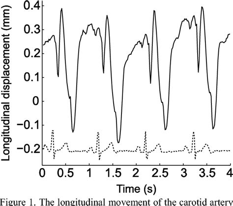 Figure 1 From A Fast 2d Tissue Motion Estimator Based On The Phase Of The Intensity Enables