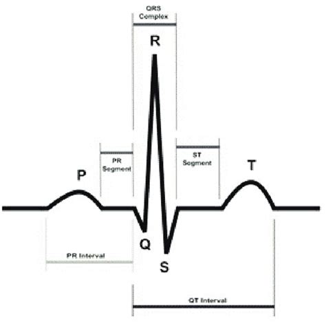 Pdf Premature Ventricular Contraction Pvc Detection Using R Signals