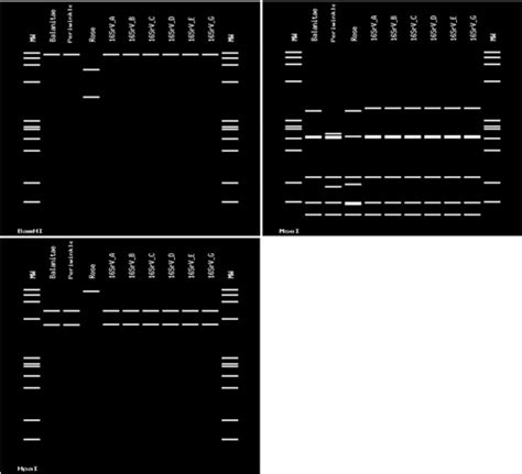 Virtual Rflp Presentation With Key Restriction Enzymes Virtual Rflp Download Scientific