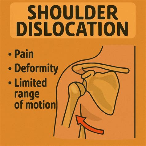 Shoulder Dislocation Reduction Techniques And Ed Management