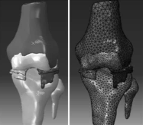 The 3d Finite Element Model Of The Subjects Knee The Model Shown Download Scientific Diagram