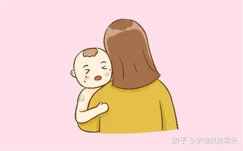 肤康 科普孩子身上出现有胎记能去除吗 知乎