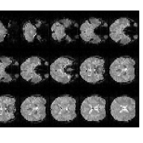 Typical Fmri Data In One Particular Time Point The Figure Presents 15 Download Scientific