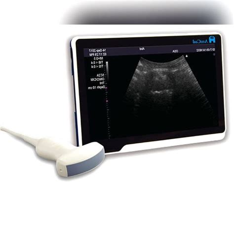 Durable Obstructive Sleep Apnea Detection Remote Controlled Ultrasound