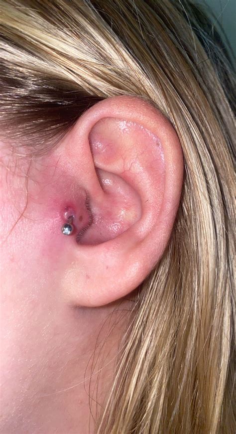 Tragus Ear Piercings Infection