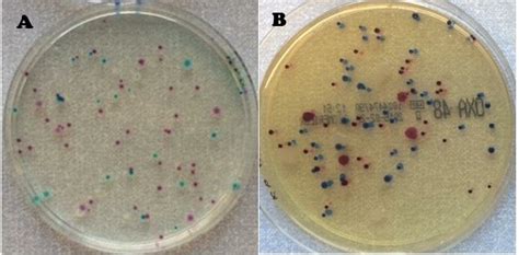 Chromogenic Plates A Chromagar Ecc Chromagar France Chromogenic