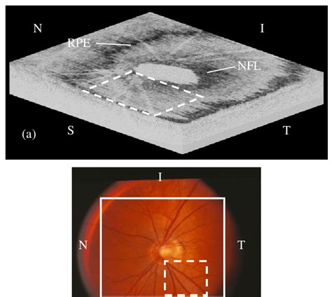 A 2 5 Mb 3 Dimensional Reconstruction Of The Retina From The Images Download Scientific