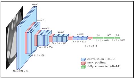 Brain Tumor Analysis Using Deep Learning And Vgg 16 Ensembling Learning