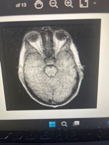 Artifact Analysis Hw Flashcards Quizlet