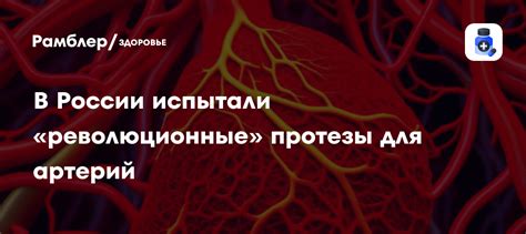 В России испытали «революционные протезы для артерий Рамблер здоровье