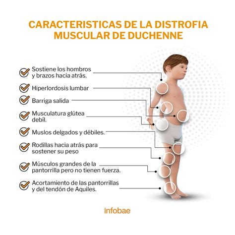 Qué Es La Distrofia Muscular De Duchenne La Enfermedad Poco Frecuente