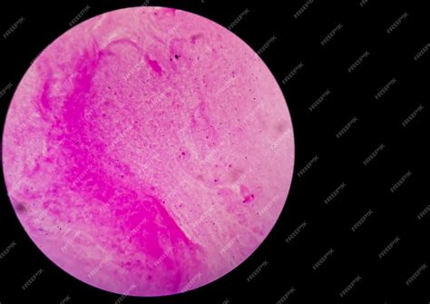Premium Photo Sputum Smear Under Microscopy Showing Gram Positive Cocci Bacteria
