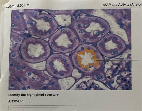 Solved Identify The Highlighted Structure 42223 850 Pm Map Lab Course Hero