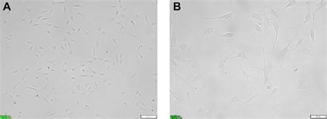 The Morphology Of Huvec A549 Cells After Cell Sorting A The Download Scientific Diagram