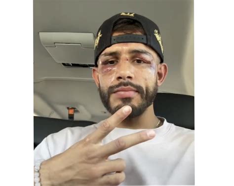 Yair Rodriguez Issues Statement Following Ufc 290 Loss To Alexander Volkanovski