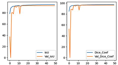 Lung Image Segmentation With Improved U Net V Net And Seg Net Techniques Peerj