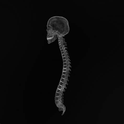 X Ray Ct Effect 3d Material With Skull And Spine Bones 3d Model