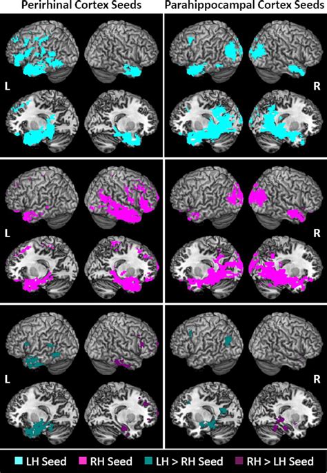 Parahippocampal Cortex