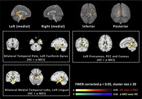 Between Group Rcbf Difference Maps For Scene Encoding Task After Download Scientific Diagram