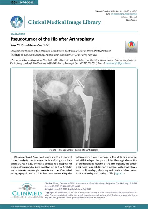 Pdf Pseudotumor Of The Hip After Arthroplasty