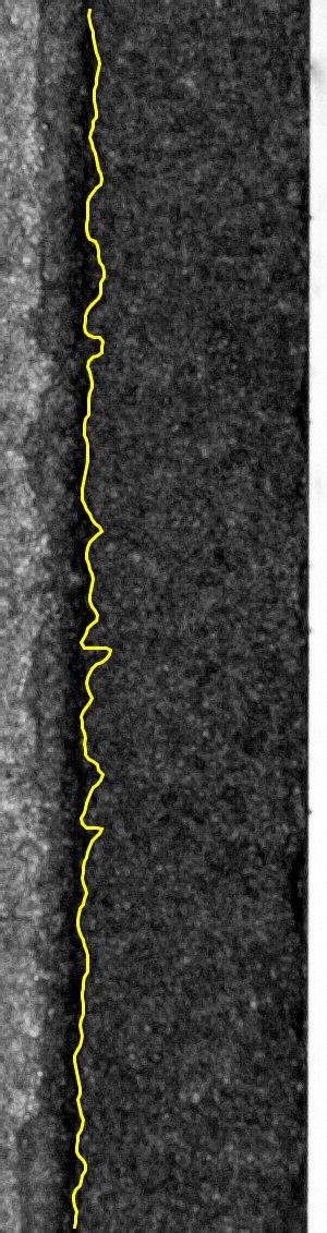 Measuring Distance Between Two Lines Image Analysis Imagesc Forum