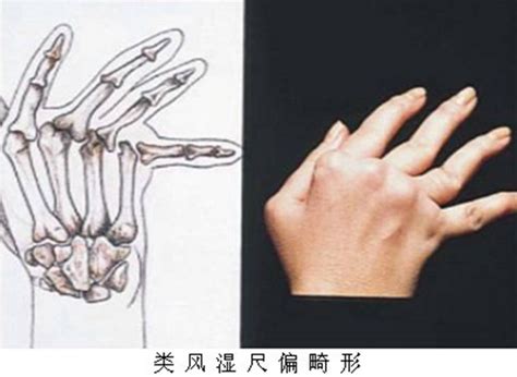 图片 症状表现图片大全 有来医生