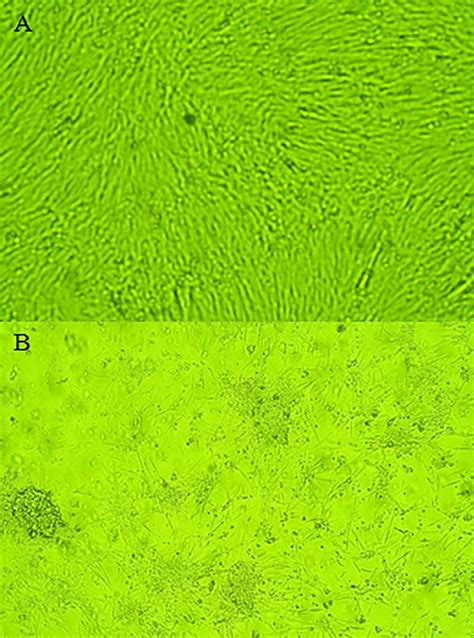 Cytopathic Effect Of Fadv In Cef Cells A Eighty Percent Confluent Cef