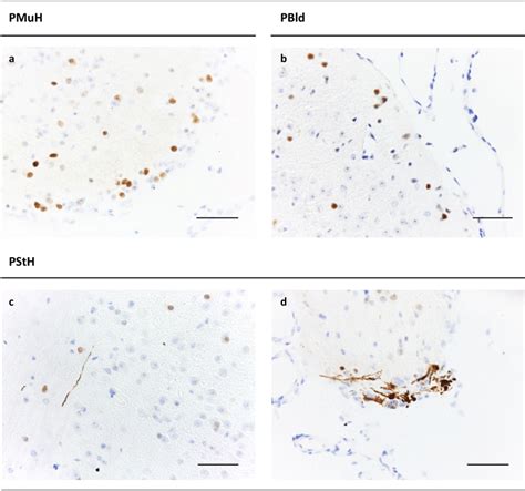 Immunohistochemical Analysis Of Cerebral αsyn Pathology In Tgm83−