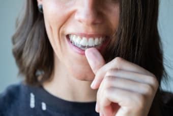 Chewies For Invisalign What Are Chewies For Invisalign