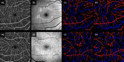 Examples Of Control And Dr Top And Bottom Respectively A Input Download Scientific Diagram