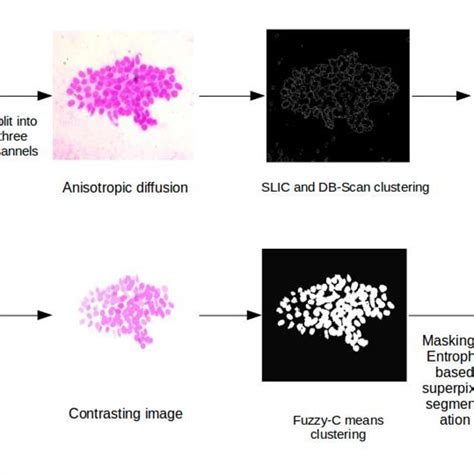 A Block Diagram Of The Superpixel Based Segmentation Download