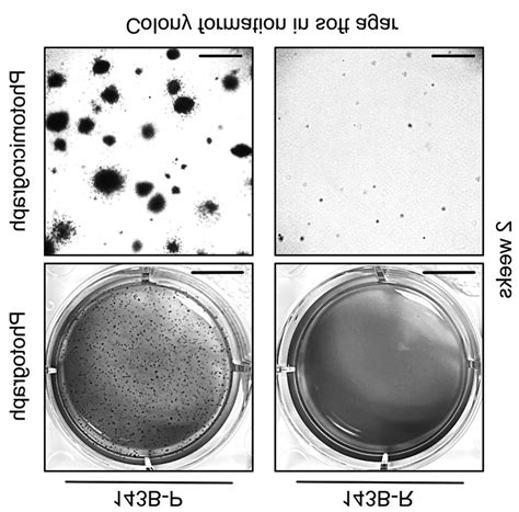 Clonogenic Assay In Soft Agar For 143b P And 143b R Cells After