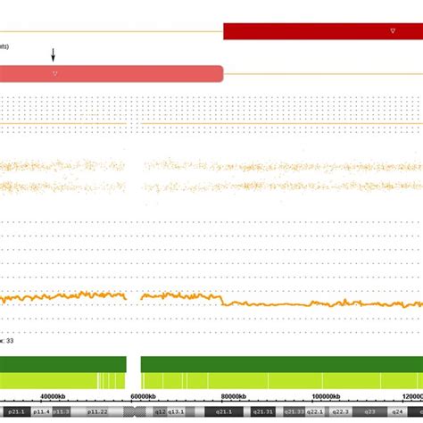 Chromosome Microarray Analysis Shows Loss Of Mosaic Arr Grch37