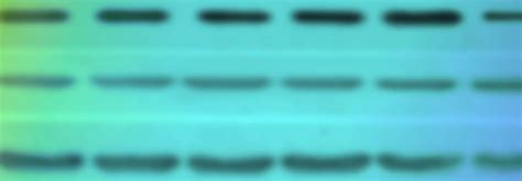 Western Blot Analysis Genetoprotein
