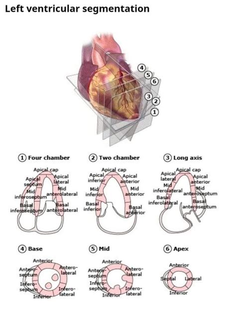 Echocardiographic Views And Location Of Regional Wall Motion Abnormalities Abdul Sami Ansari