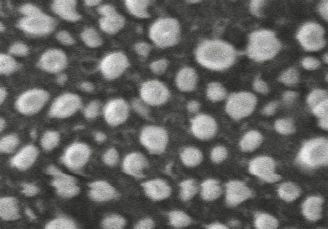 Sem Object Detection Dataset By Diploma