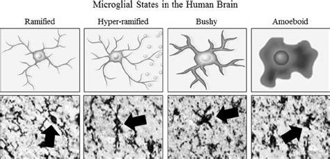 Fig 1 Activated Morphology Of Microglia Representative Schematics And Photomicrographs Of
