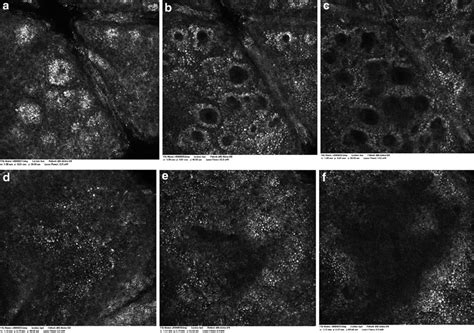 Dermal Epidermal Junction Pattern Of Young A C And Aged Skin D F Download Scientific