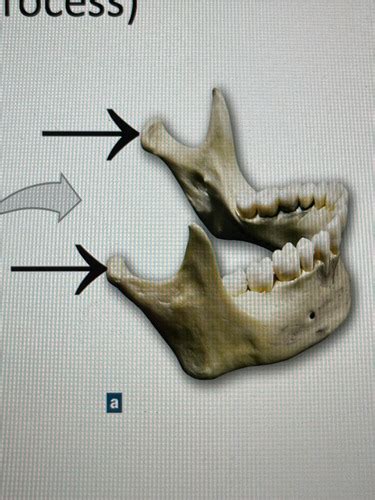 Aandp Lab The Mandible And Fetal Skull Flashcards Quizlet