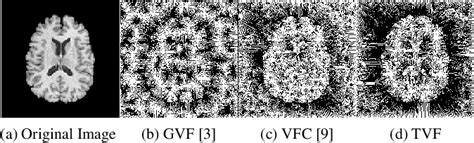 Figure 1 From Tensor Vector Field Based Active Contours Semantic Scholar