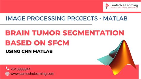 Brain Tumor Segmentation Based On Sfcm Using Cnn Matlab Youtube