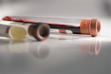 What Is The C Reactive Protein CRP Test Used For