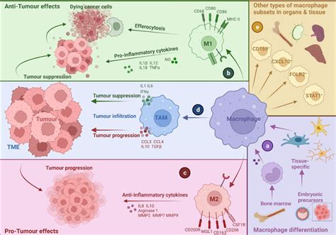 Figure From The Interface Of Tumour Associated Macrophages With Dying Cancer Cells In Immuno